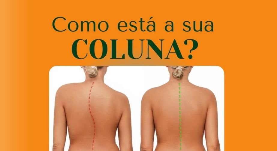 Como está a sua Coluna - Quiropraxia em Goiânia